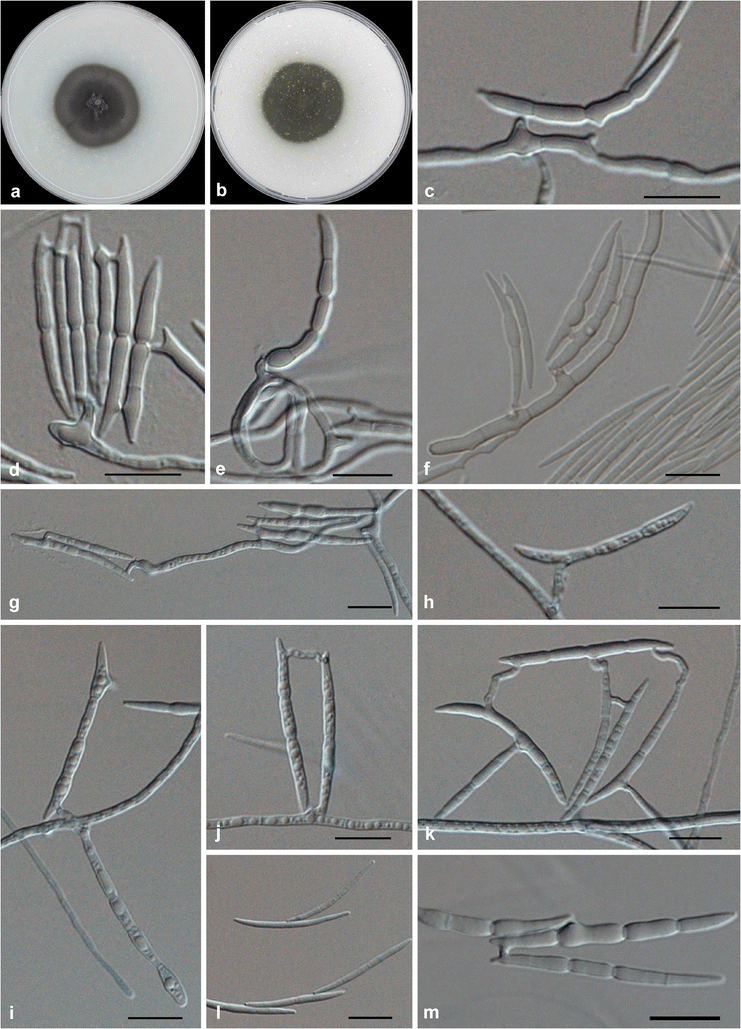 Cyphellophora and its relatives in Phialophora: biodiversity and ...