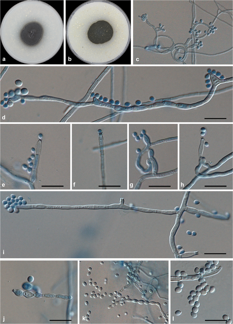Cyphellophora and its relatives in Phialophora: biodiversity and ...