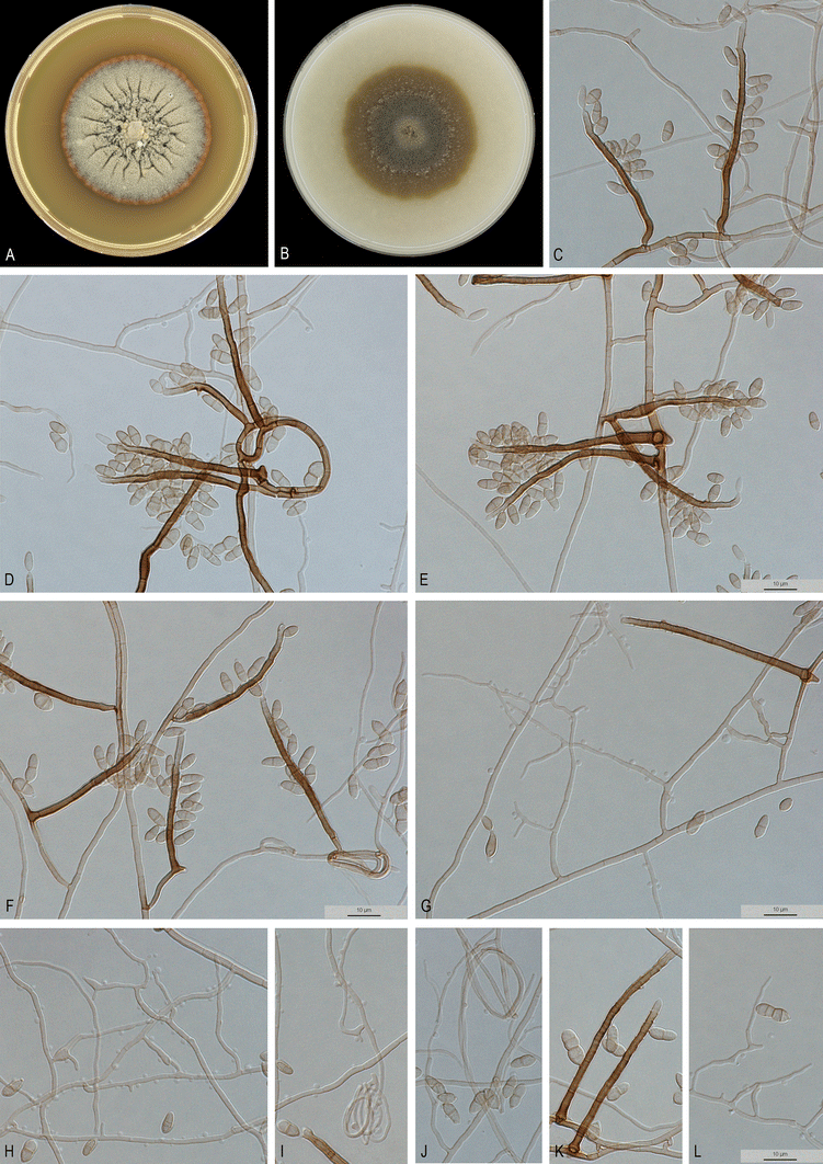 Taxonomy of Ochroconis, genus including opportunistic pathogens on ...