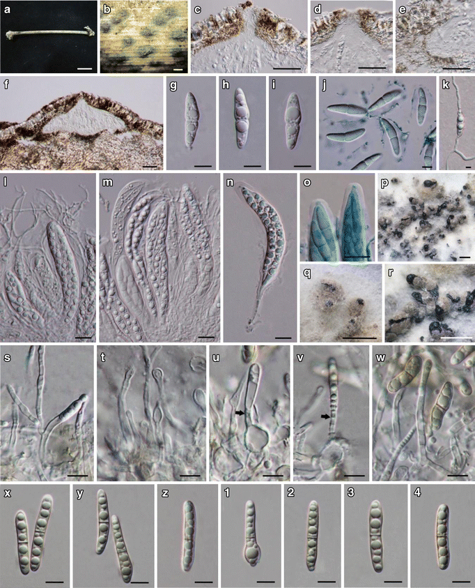 Families of Dothideomycetes | SpringerLink
