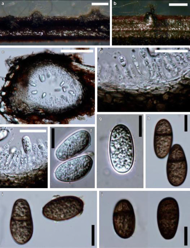 Families of Dothideomycetes | SpringerLink