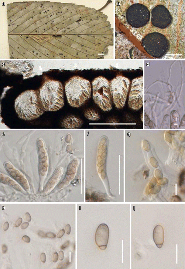 Families of Dothideomycetes | SpringerLink