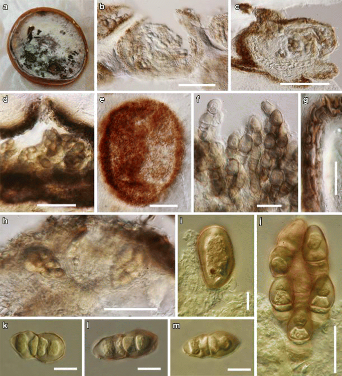 Families of Dothideomycetes | SpringerLink