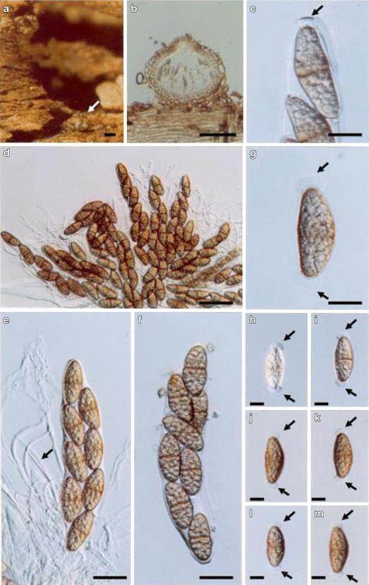 Families of Dothideomycetes | SpringerLink