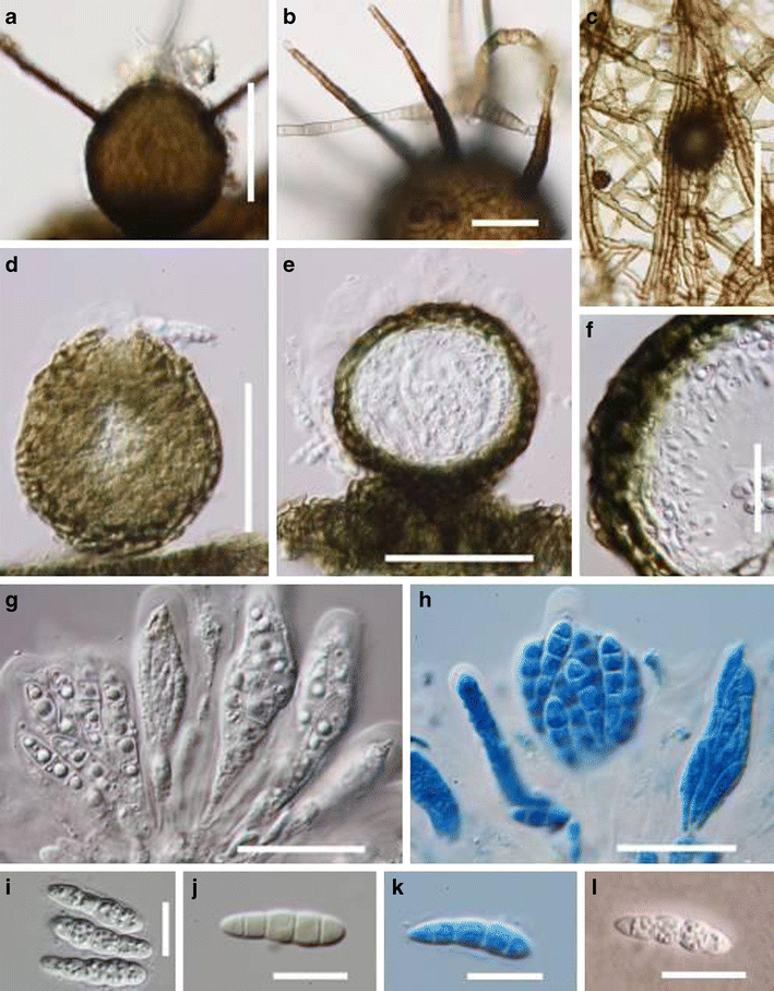 The sooty moulds | SpringerLink