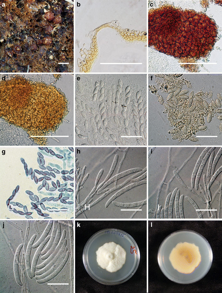 The genus Thelonectria ( Nectriaceae, Hypocreales, Ascomycota) and ...