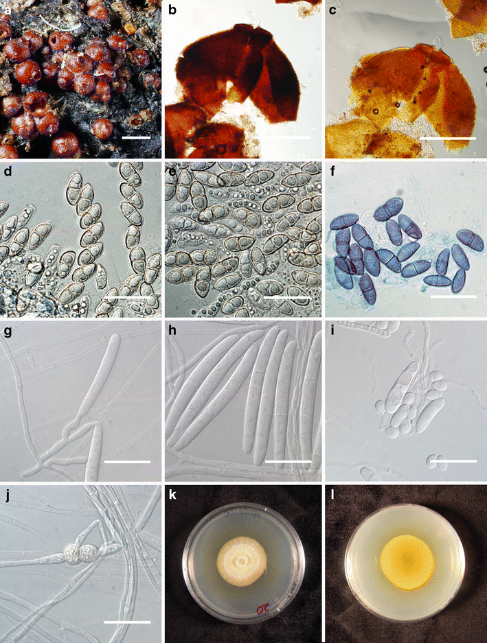 The genus Thelonectria ( Nectriaceae, Hypocreales, Ascomycota) and ...