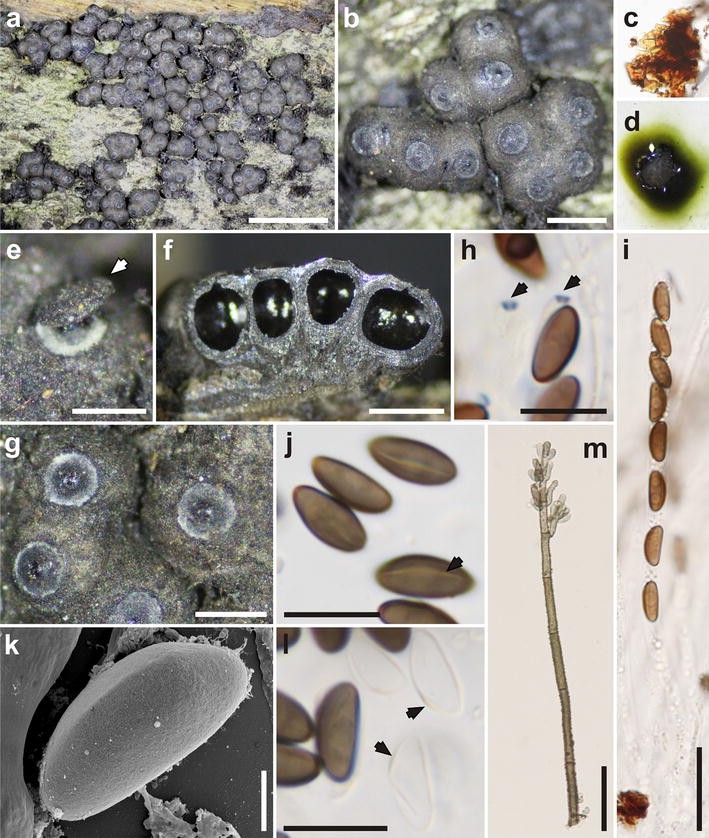 Phylogenetic and chemotaxonomic resolution of the genus Annulohypoxylon ...