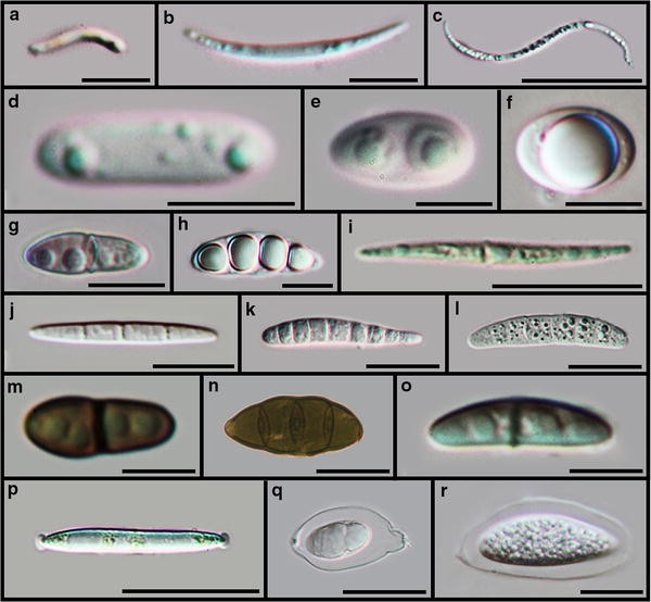 DISCOMYCETES: the apothecial representatives of the phylum Ascomycota ...