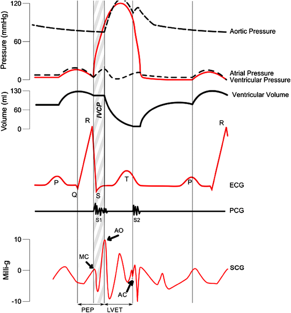 Systolic Time Intervals and New Measurement Methods | SpringerLink