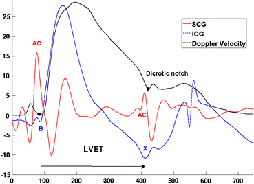 Systolic Time Intervals and New Measurement Methods | SpringerLink