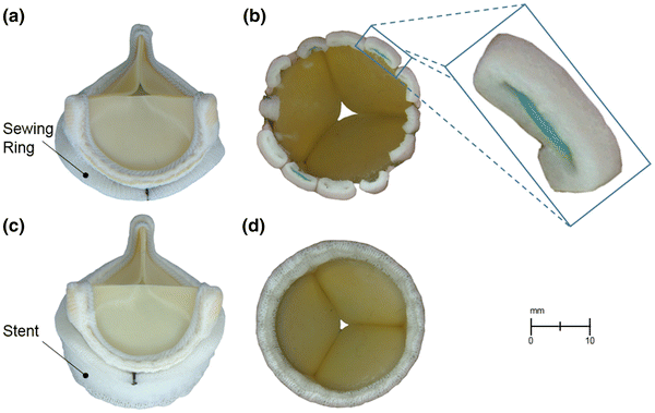 Pledget-Armed Sutures Affect the Haemodynamic Performance of Biologic ...