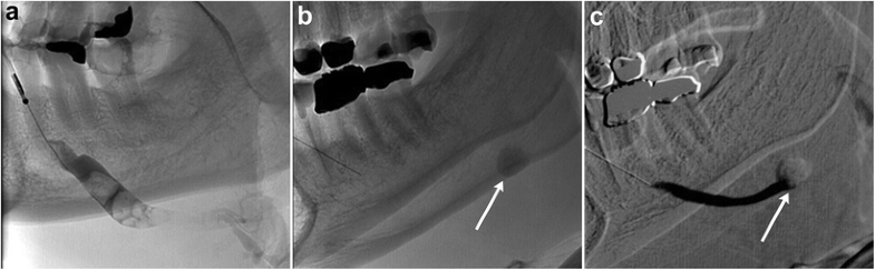 Imaging of the sublingual and submandibular spaces | SpringerLink