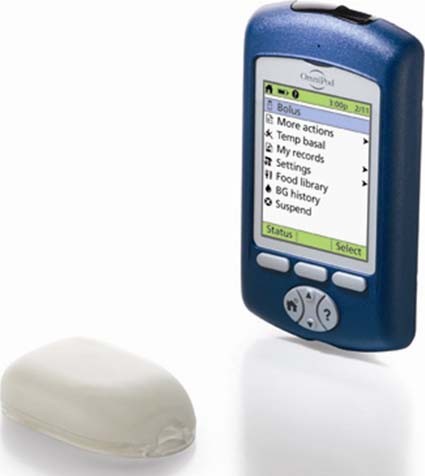 The OmniPod Insulin Management System: the latest innovation in insulin ...