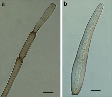 First report of Corynespora cassiicola on Pueraria phaseoloides ...