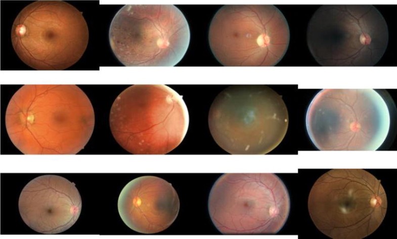 Deep-learning-based automatic computer-aided diagnosis system for ...