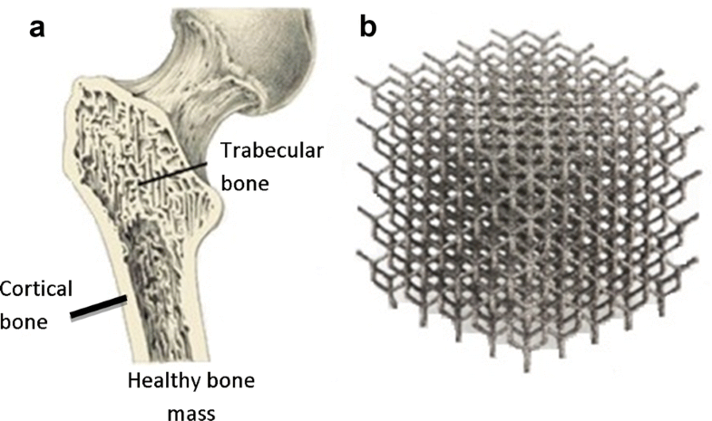 Design and 3D-printing of titanium bone implants: brief review of ...