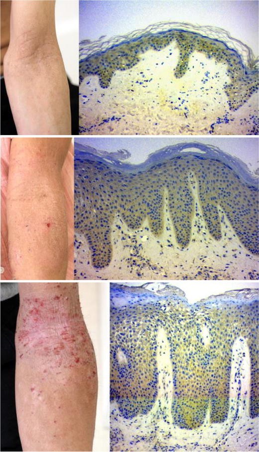 Histological and Immunohistological Findings Using Anti-Cortisol ...
