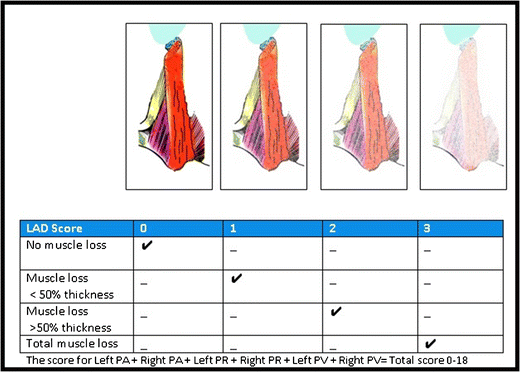 Use of Ultrasound Imaging in Pelvic Organ Prolapse: an Overview ...