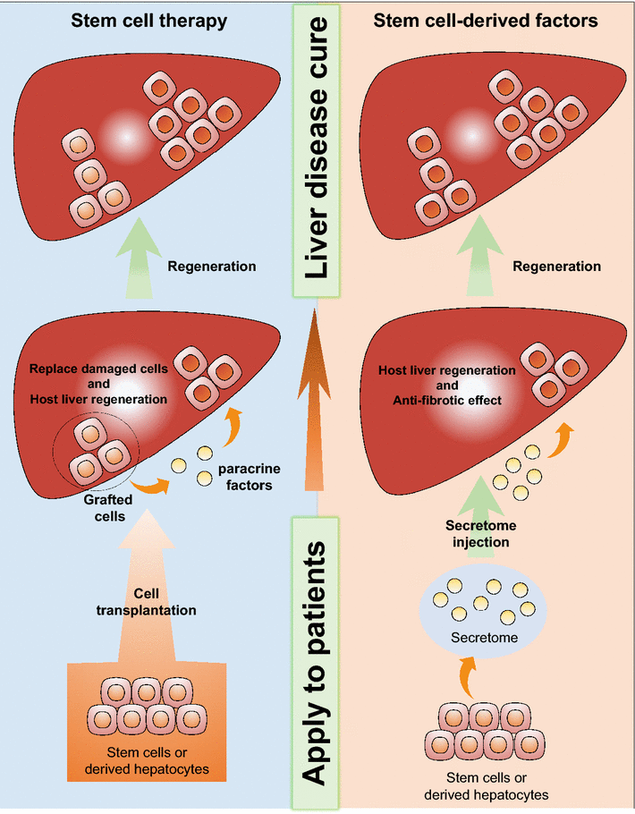 Current Understanding of Stem Cell and Secretome Therapies in Liver ...