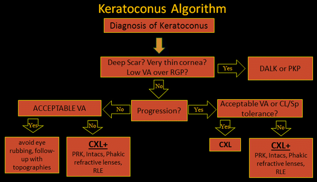 Keratoconus Treatment Algorithm | SpringerLink