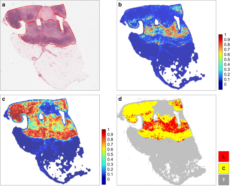 The Emergence of Pathomics | SpringerLink