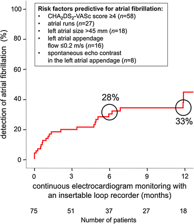 Management of Embolic Stroke of Undetermined Source (ESUS) | SpringerLink