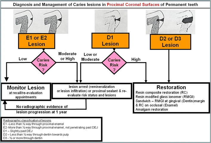 Remineralization Therapies for Initial Caries Lesions | SpringerLink