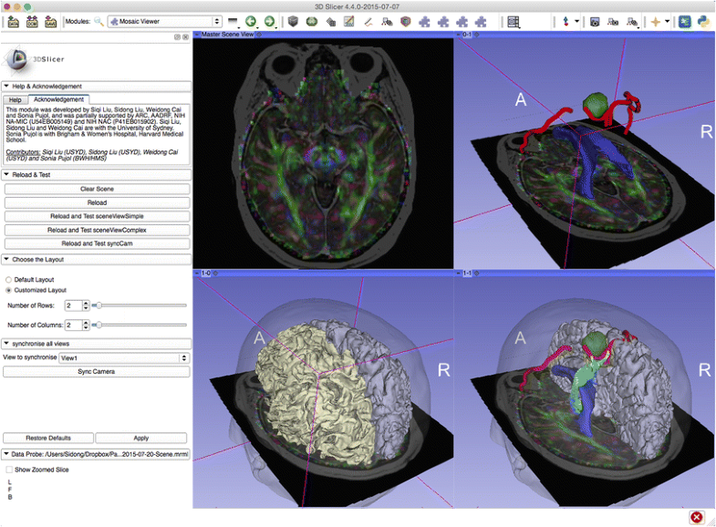 Multimodal neuroimaging computing: the workflows, methods, and platforms | Brain Informatics ...