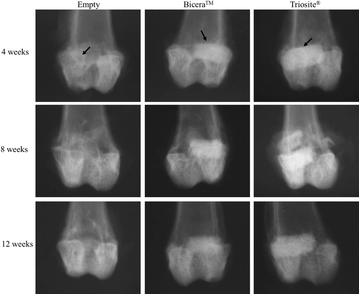 Evaluation of New Biphasic Calcium Phosphate Bone Substitute: Rabbit ...