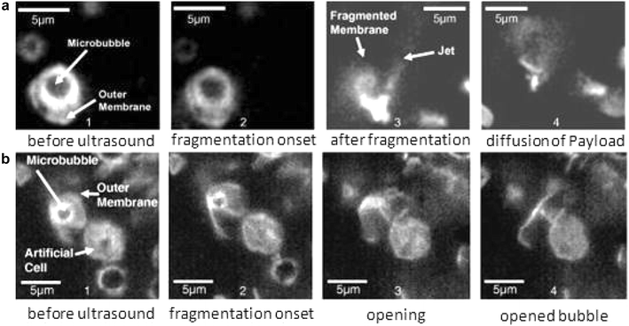 Ultrasound Cavitation/Microbubble Detection and Medical Applications ...