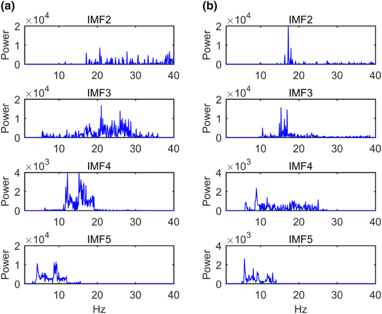 An EEG-Based Attentiveness Recognition System Using Hilbert–Huang Transform and Support Vector ...