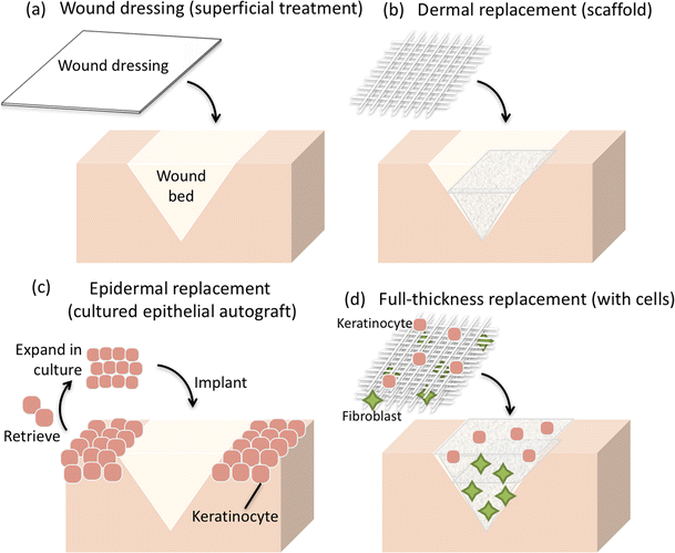 Skin Tissue Engineering: Biological Performance of Electrospun Polymer Scaffolds and ...