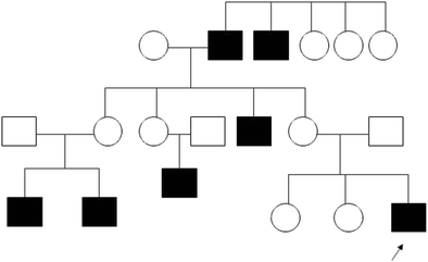 Central precocious puberty in a case of late-diagnosed familial ...