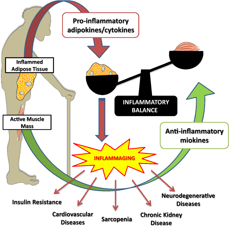 Exercise Training for the Elderly: Inflammaging and the Central Role for HSP70 | SpringerLink