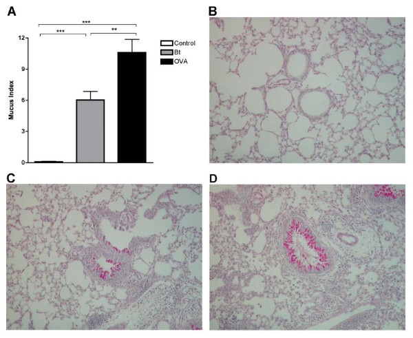 Respiratory allergy to Blomia tropicalis: Immune response in four ...
