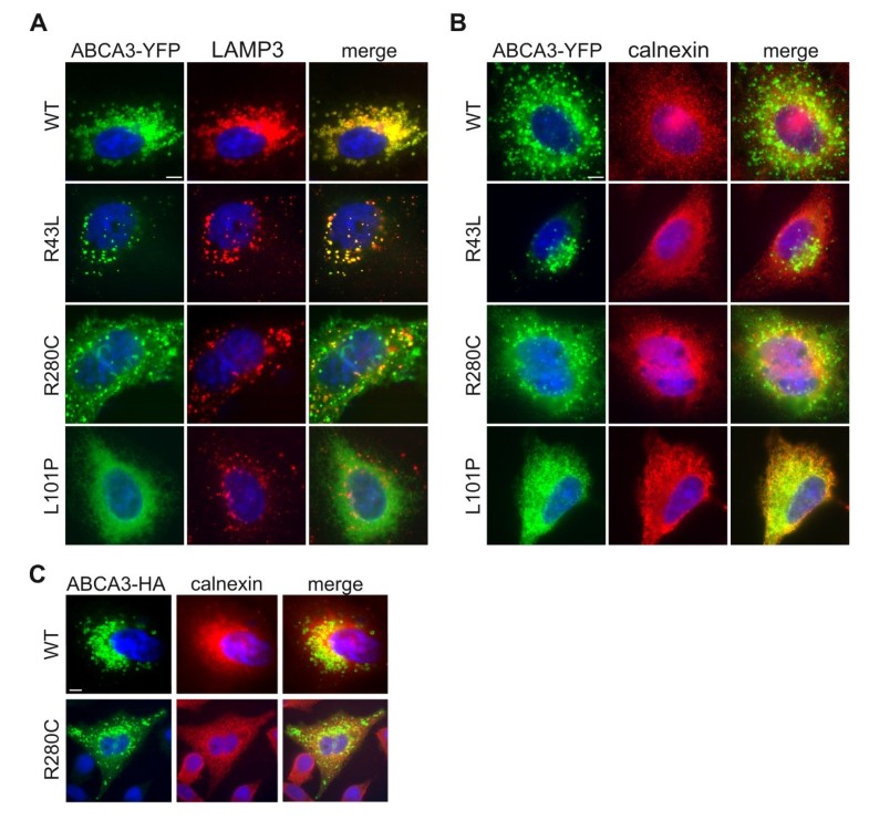 Some ABCA3 mutations elevate ER stress and initiate apoptosis of lung ...