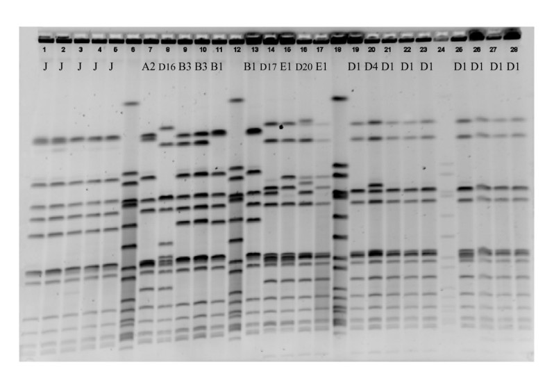 PFGE diversity within the methicillin-resistant Staphylococcus aureus clonal lineage ST398 | BMC ...