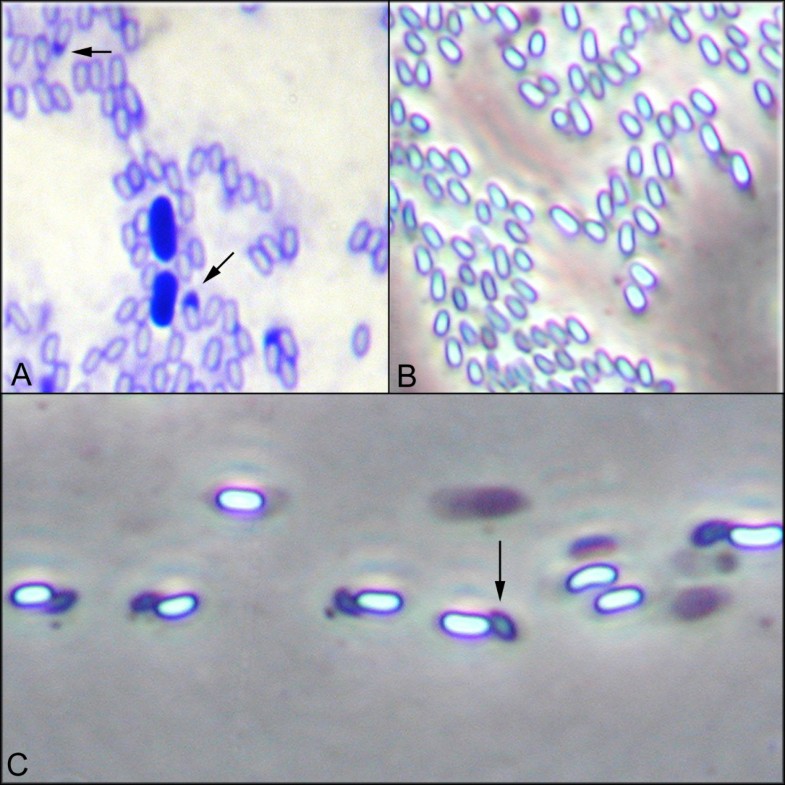 A Bacillus thuringiensis isolation method utilizing a novel stain, low ...