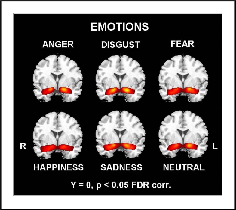 General and specific responsiveness of the amygdala during explicit ...