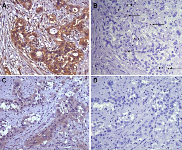 Expression Of The Costimulatory Molecule B7 H3 Is Associated With