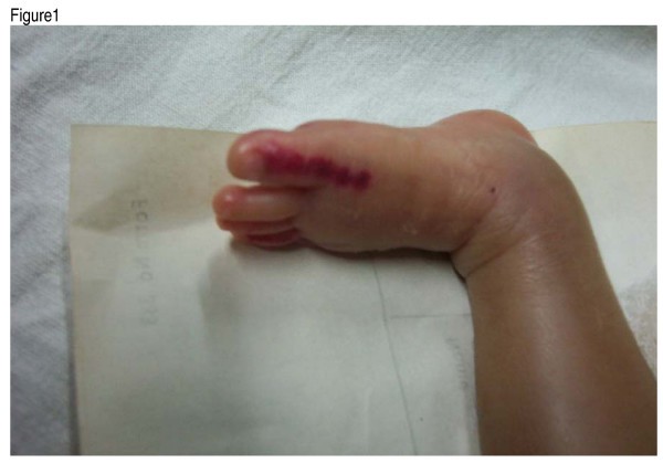 Evaluation of pulse-oximetry oxygen saturation taken through skin ...