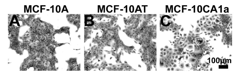 Increasingly transformed MCF-10A cells have a progressively tumor-like phenotype in three ...