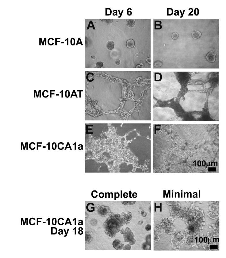 Increasingly transformed MCF-10A cells have a progressively tumor-like phenotype in three ...