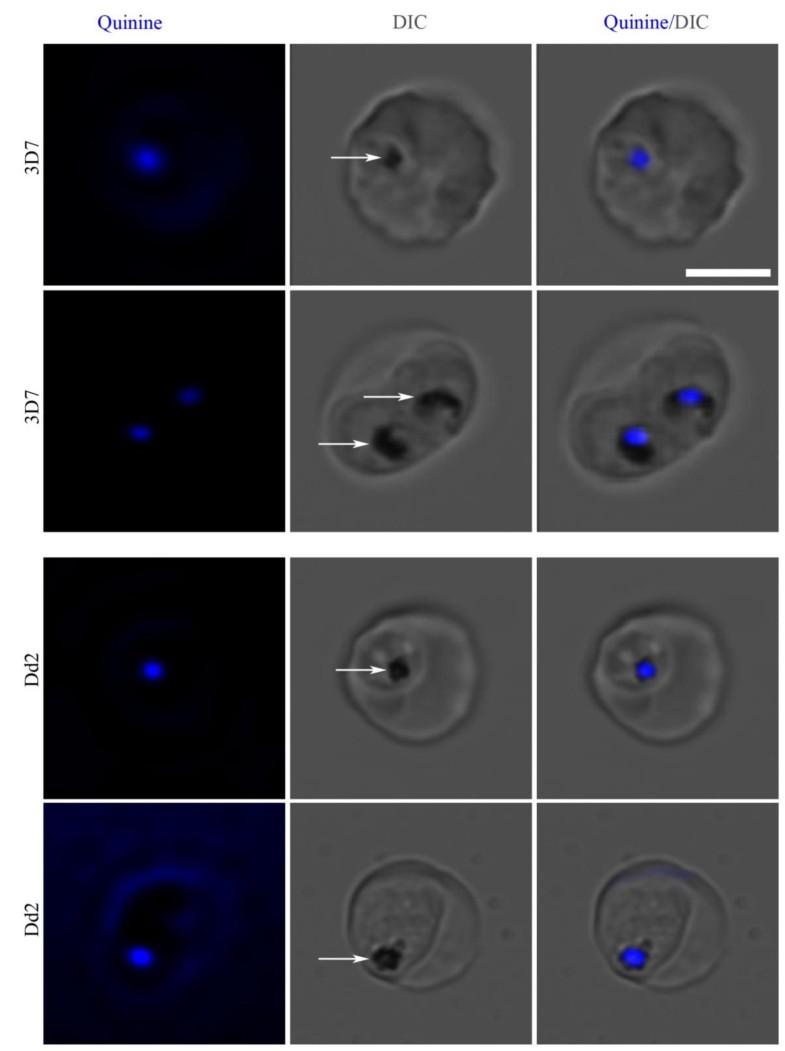 Quinine localizes to a non-acidic compartment within the food vacuole ...