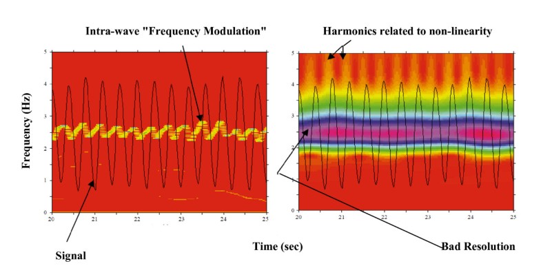 Seizure classification in EEG signals utilizing Hilbert-Huang transform | BioMedical Engineering ...