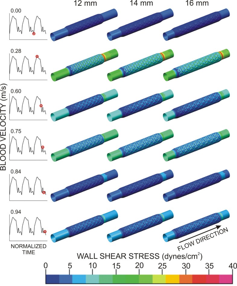 Axial stent strut angle influences wall shear stress after stent ...