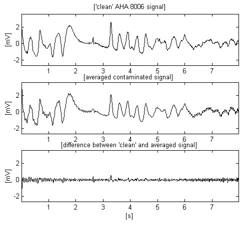 Suppression of AC railway power-line interference in ECG signals ...