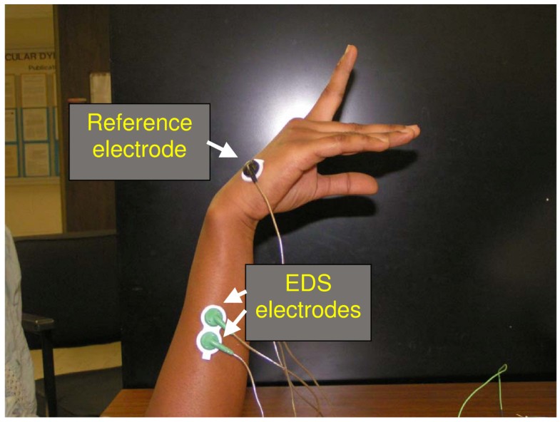 Neural network committees for finger joint angle estimation from ...