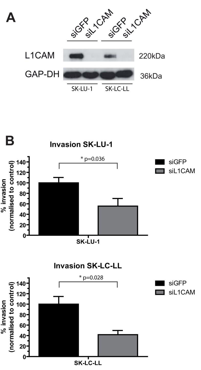 L1CAM protein expression is associated with poor prognosis in non-small ...